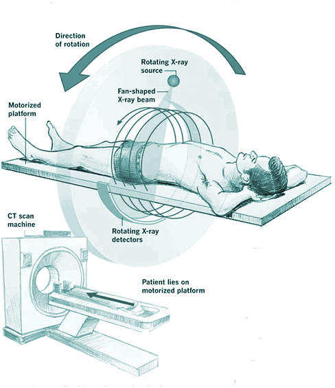 Neuroconductor: An R Platform for Medical Imaging Analysis