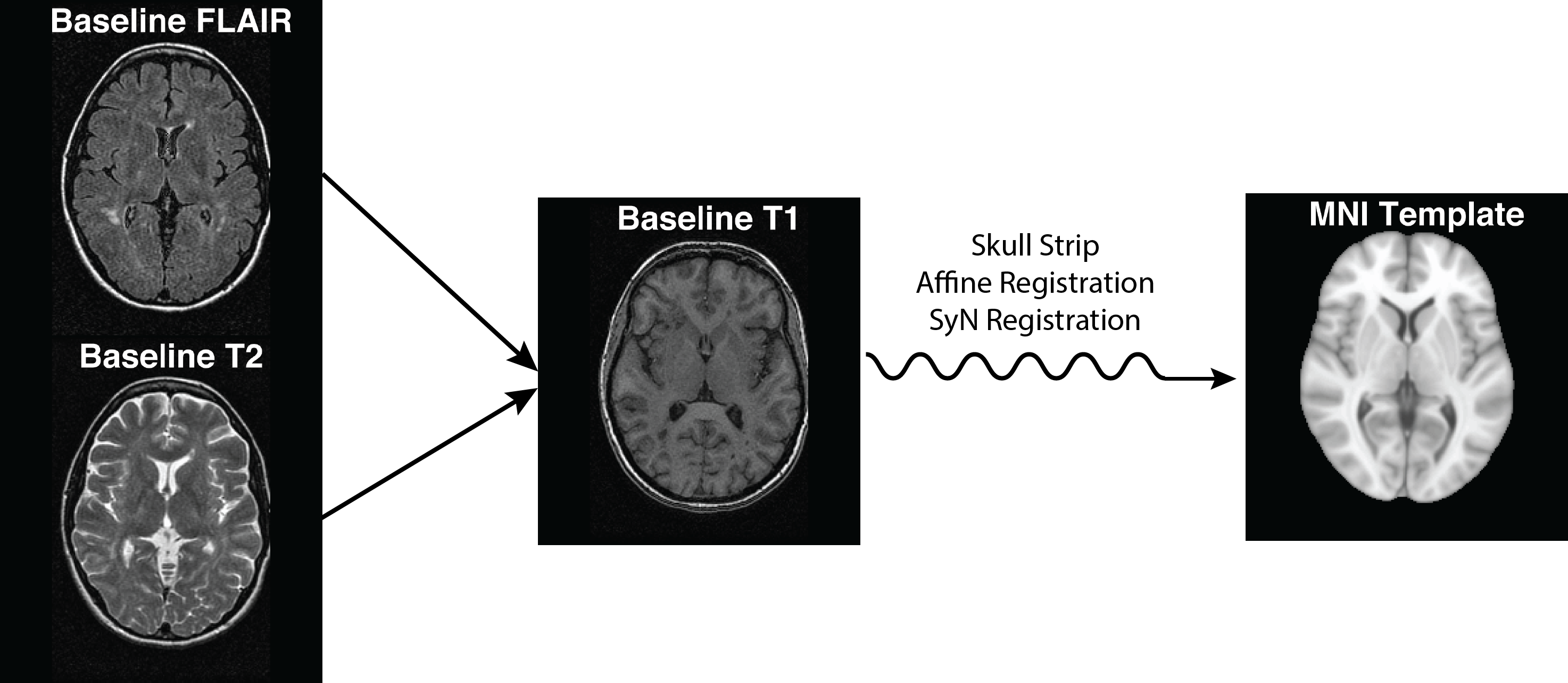 Neuroconductor: An R Platform for Medical Imaging Analysis