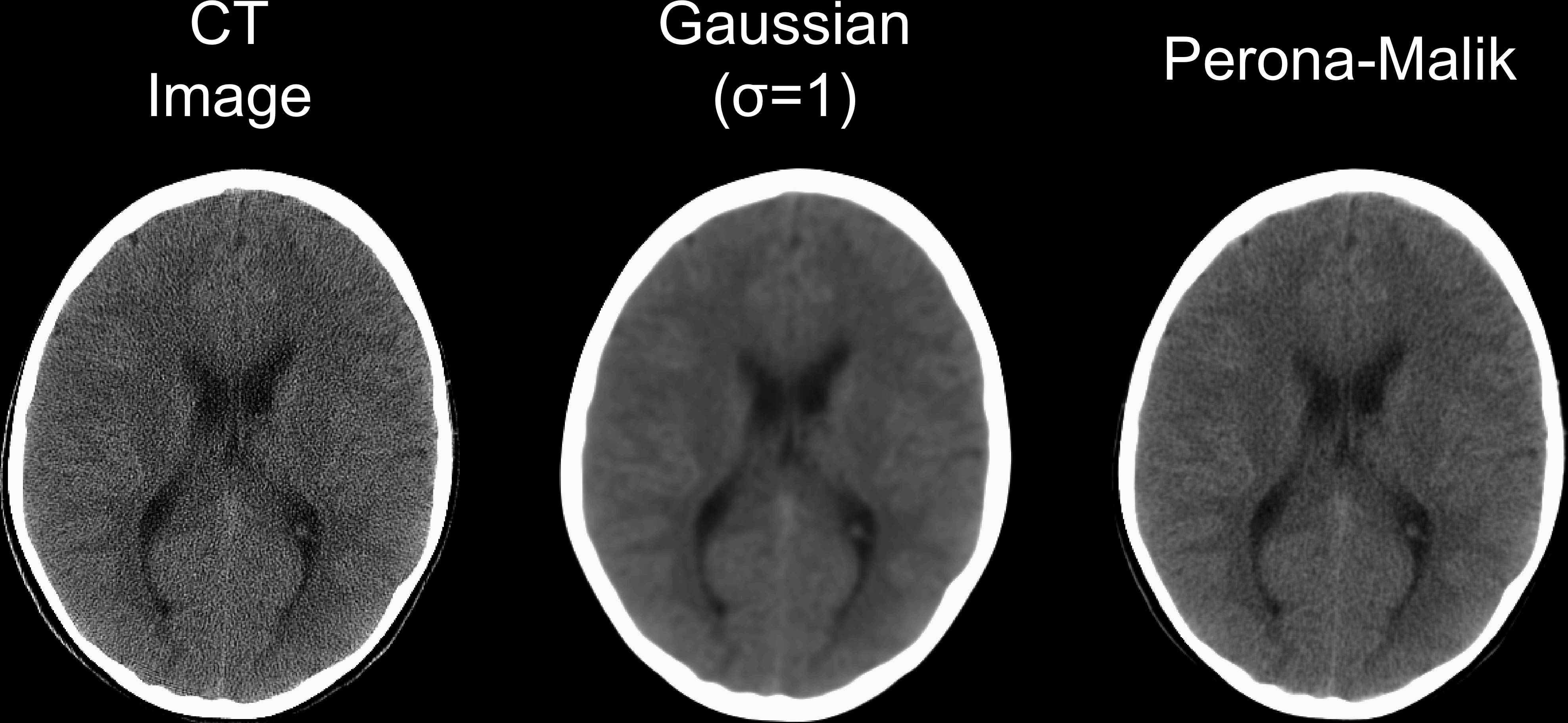 Neuroconductor: An R Platform for Medical Imaging Analysis