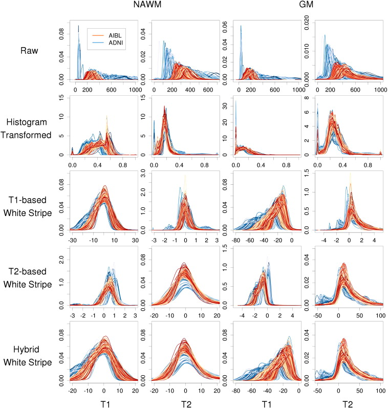 Neuroconductor: An R Platform for Medical Imaging Analysis